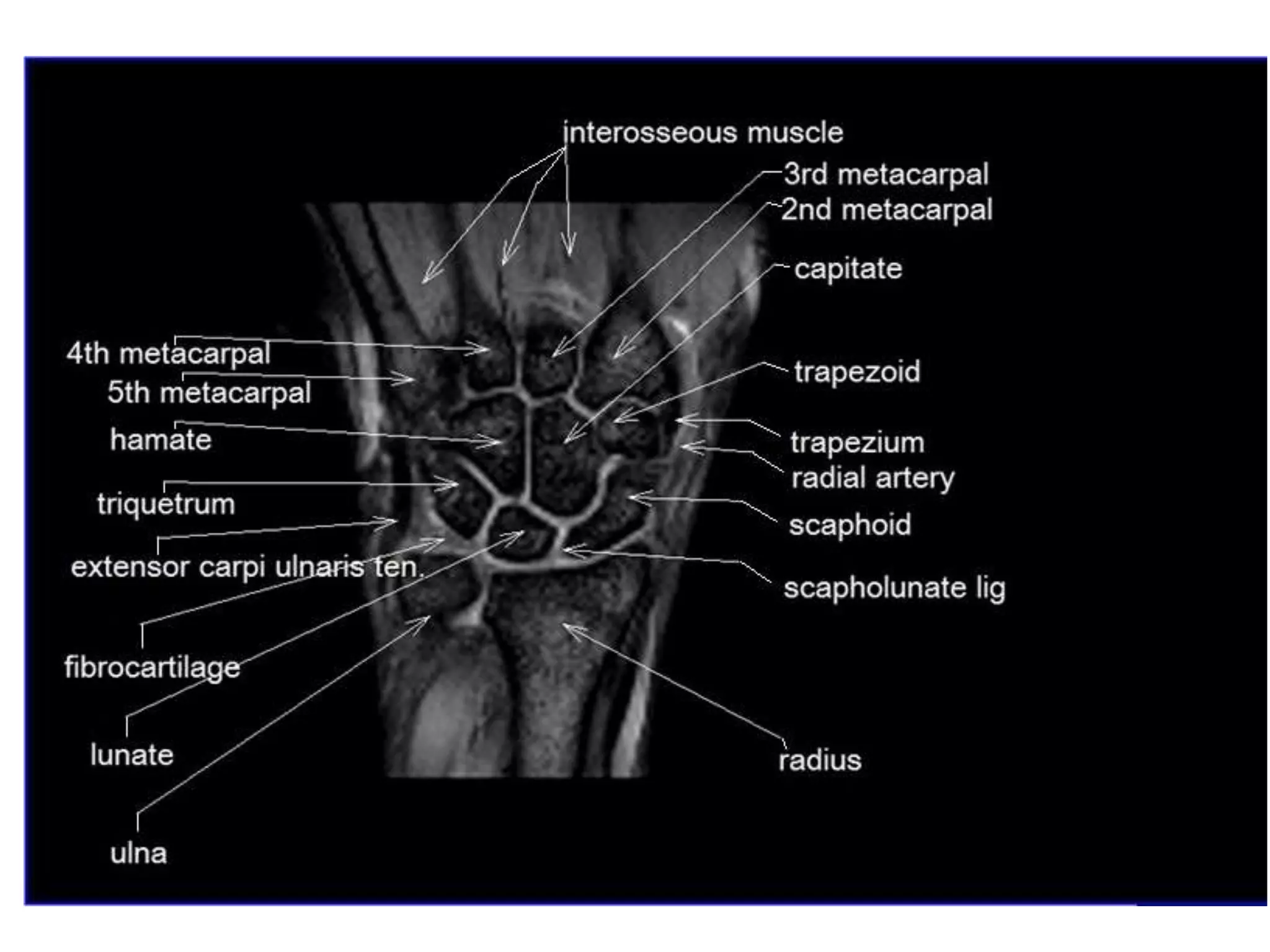 Mri msk 2 | PPTX