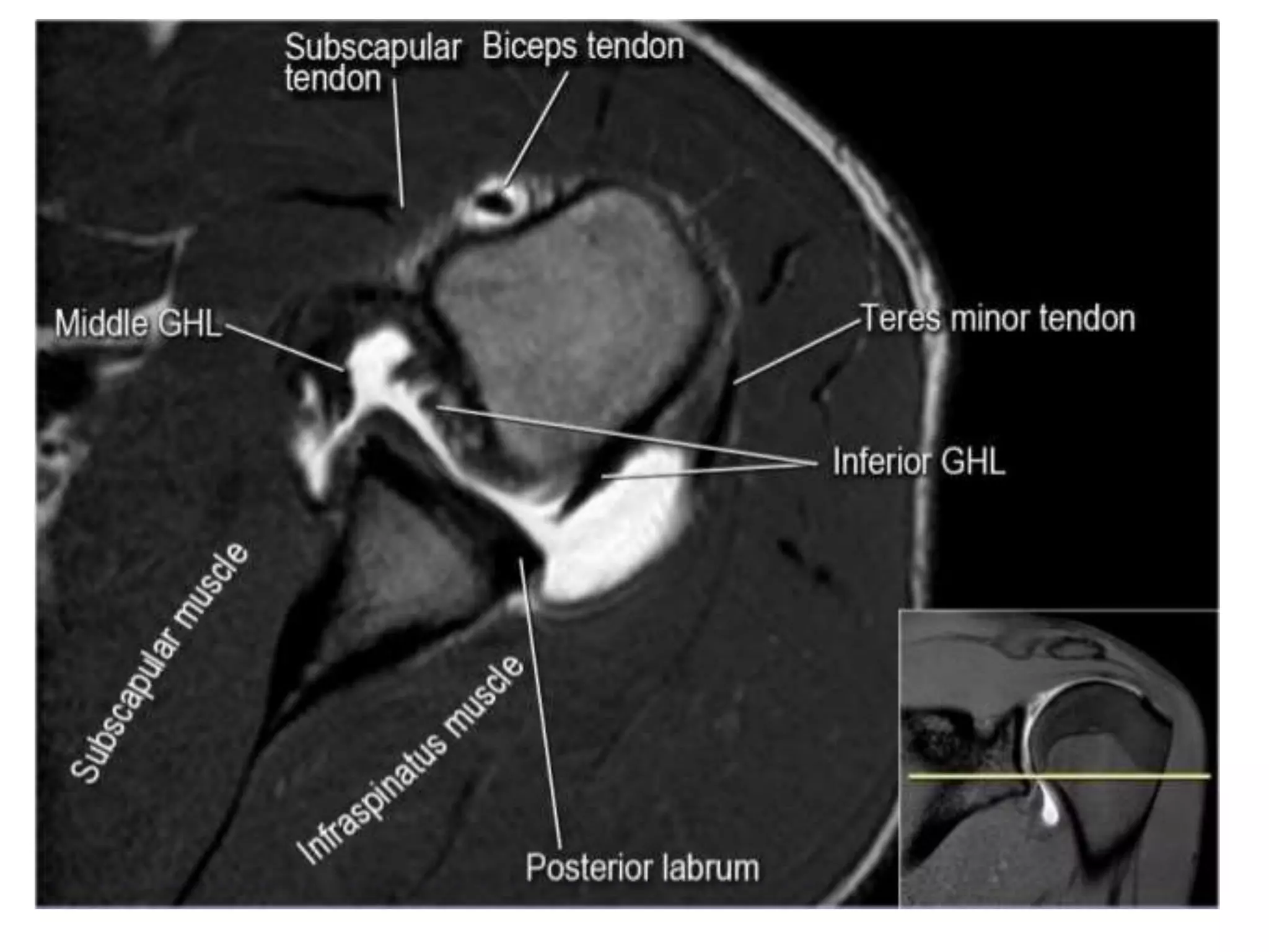 Mri musculoskeletal system | PPTX