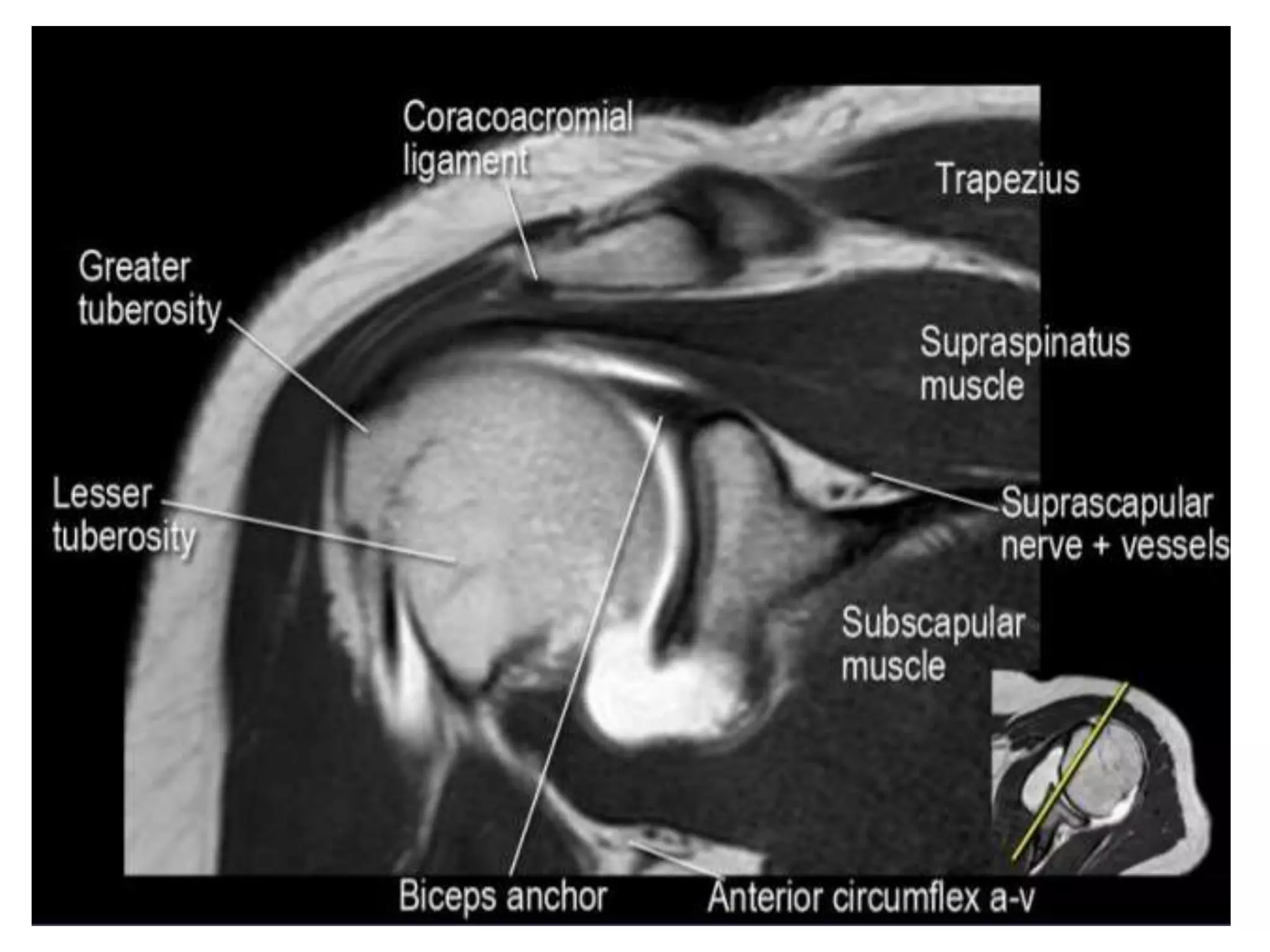Mri musculoskeletal system | PPTX