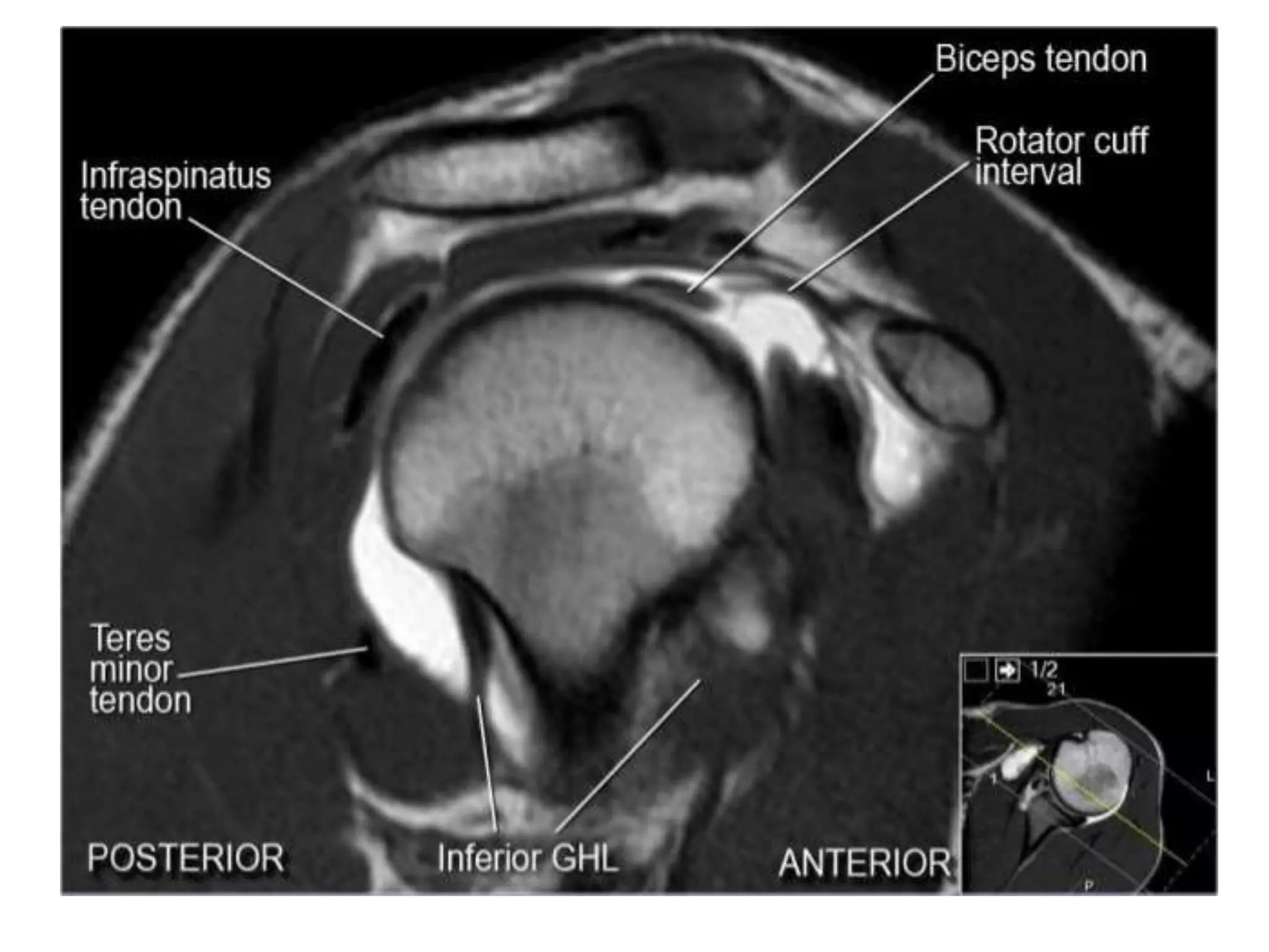 Mri musculoskeletal system | PPTX