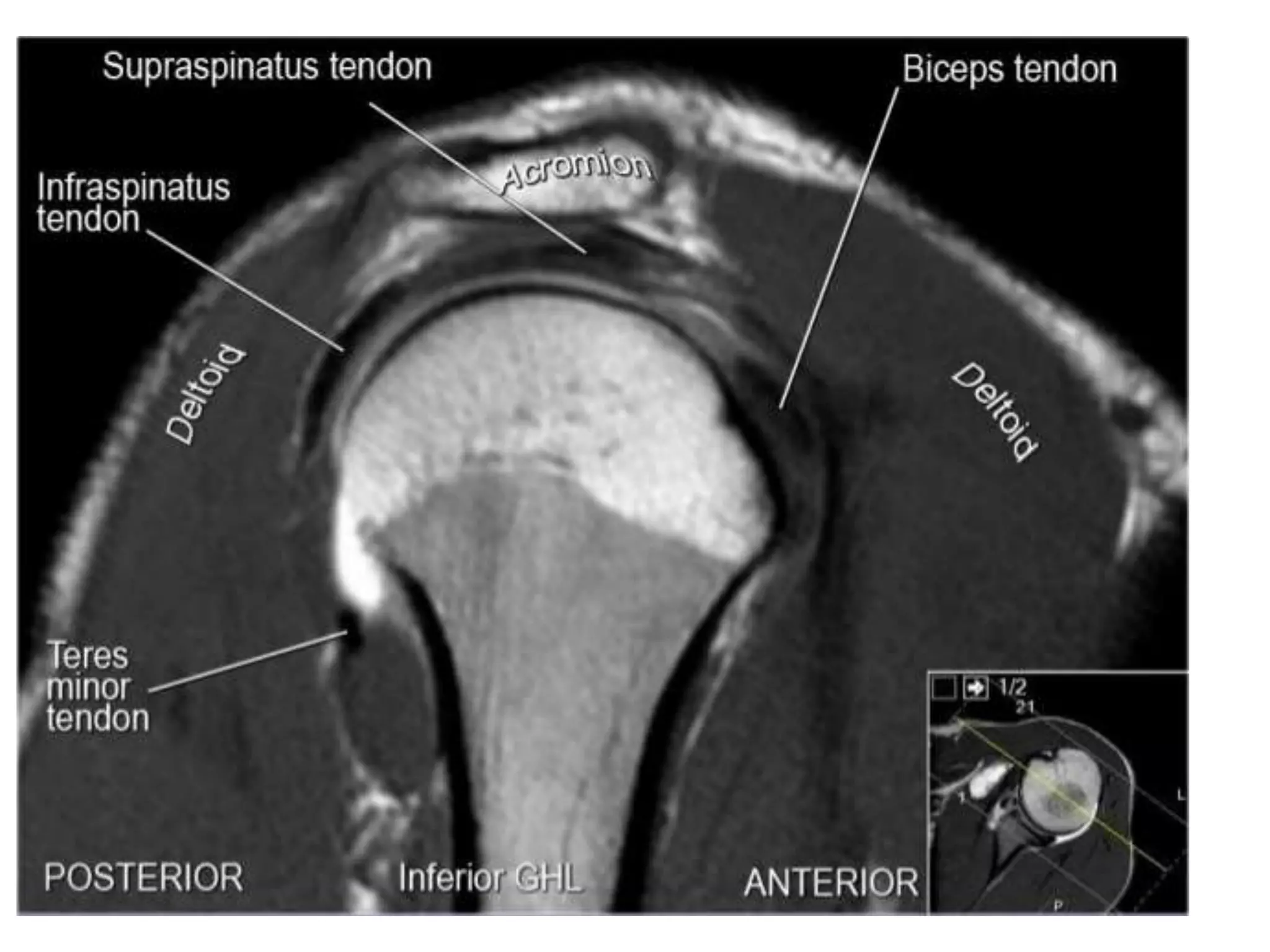 Mri musculoskeletal system | PPTX