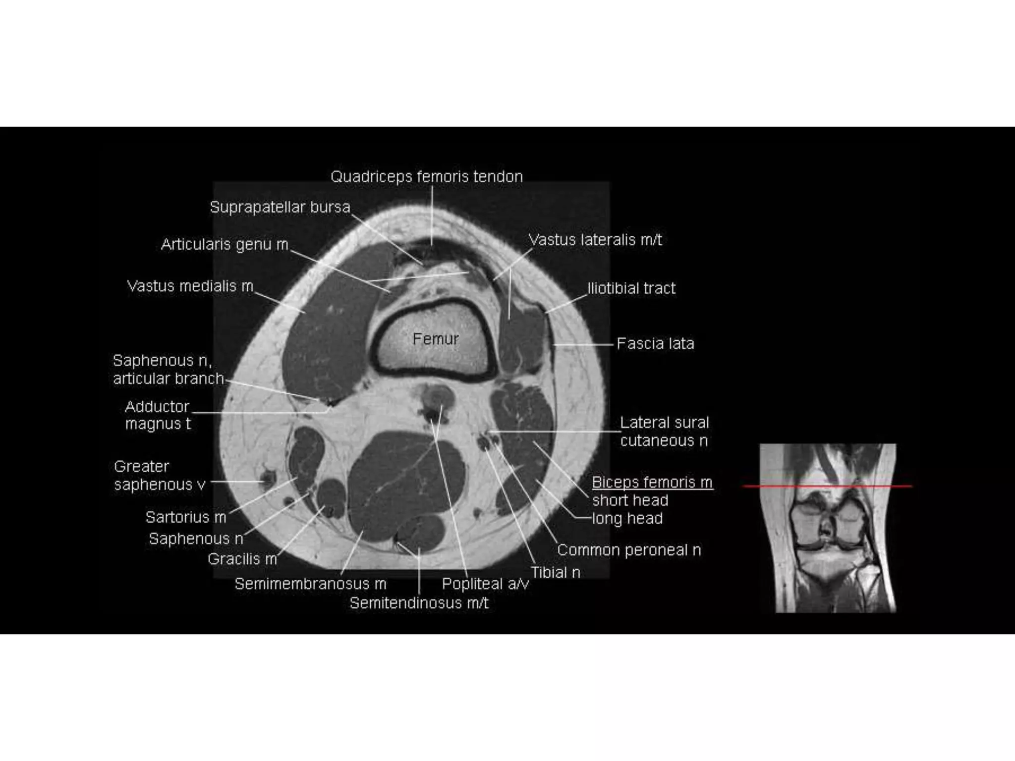 Mri musculoskeletal system | PPTX