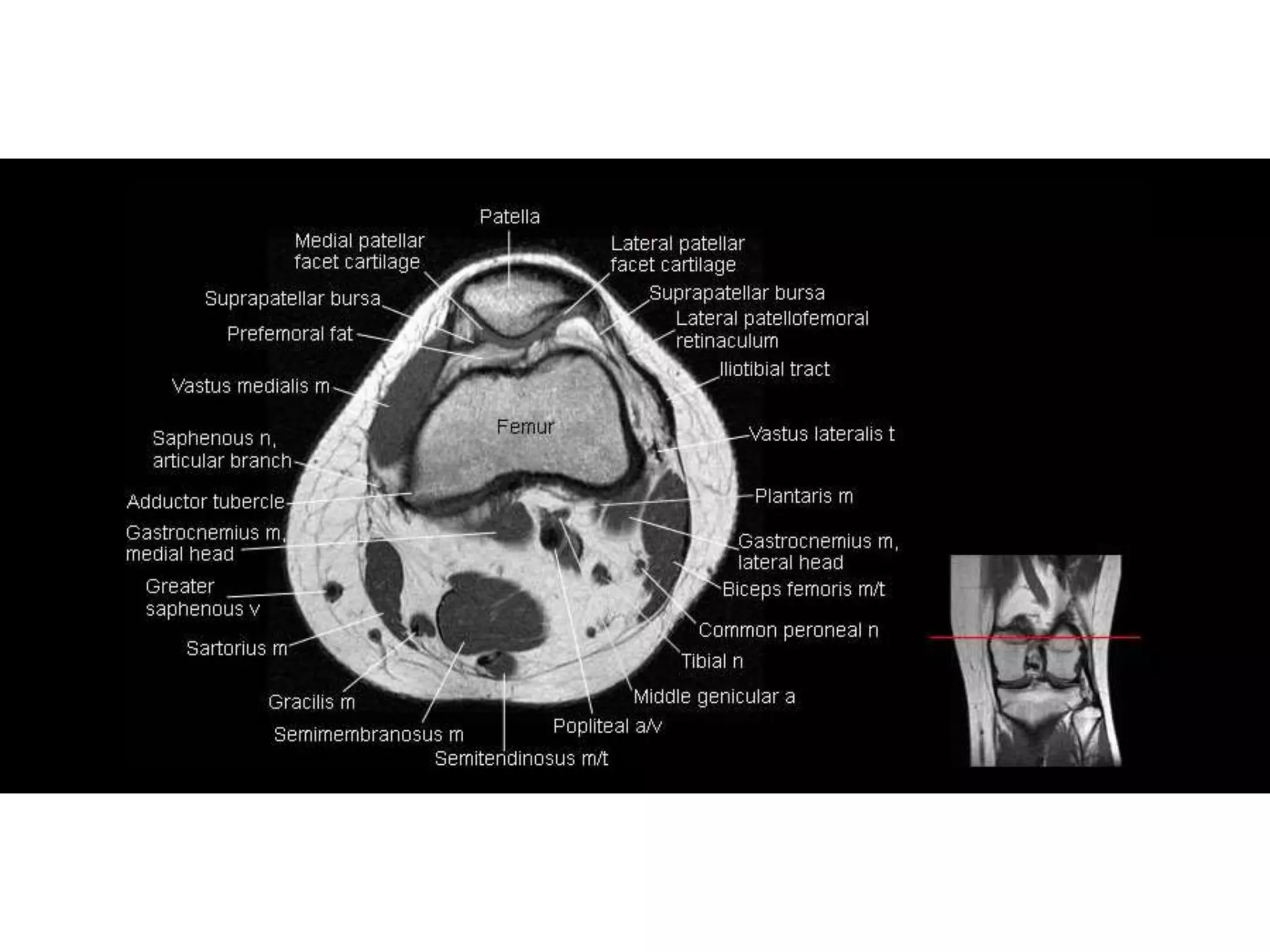 Mri musculoskeletal system | PPTX
