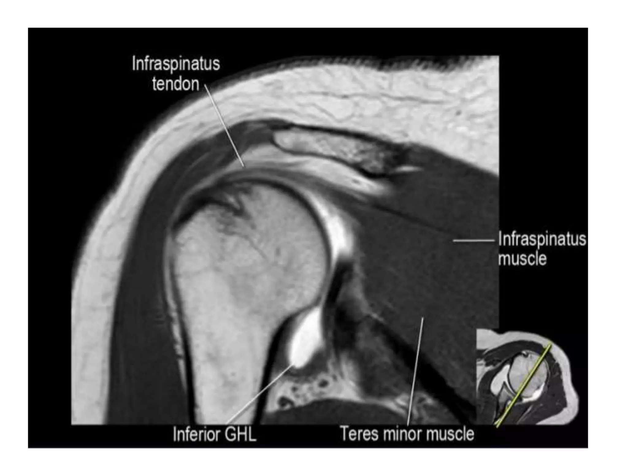 Mri musculoskeletal system | PPTX