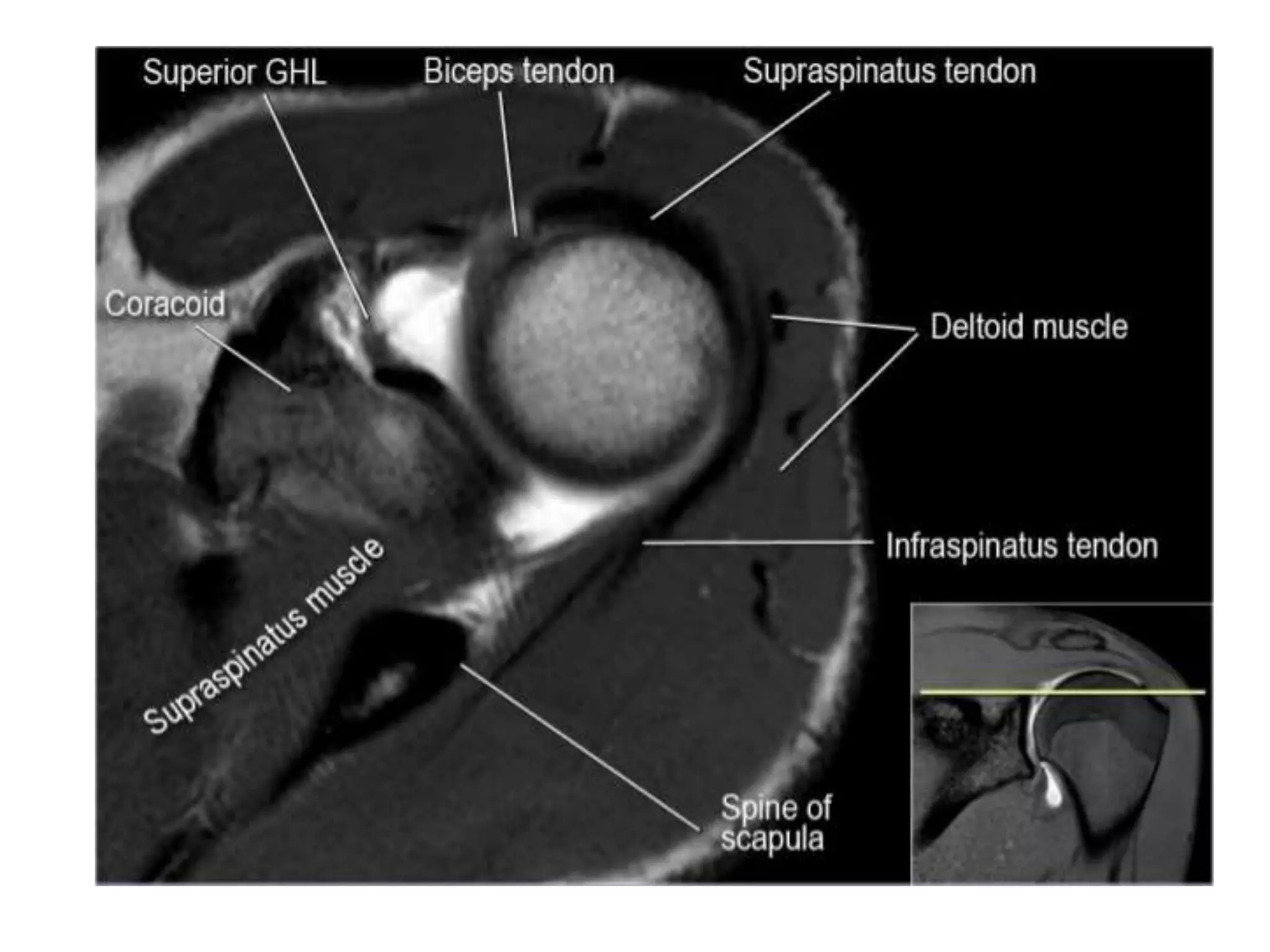 Mri musculoskeletal system | PPTX