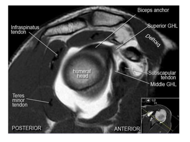 Mri musculoskeletal system | PPTX
