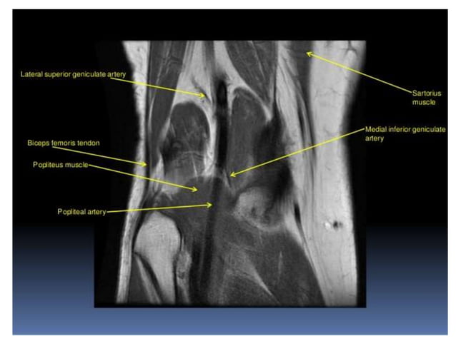Mri musculoskeletal system | PPTX