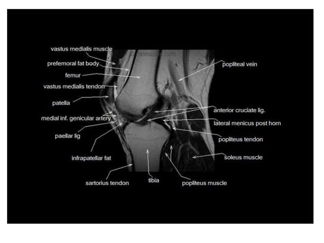 Mri musculoskeletal system | PPTX