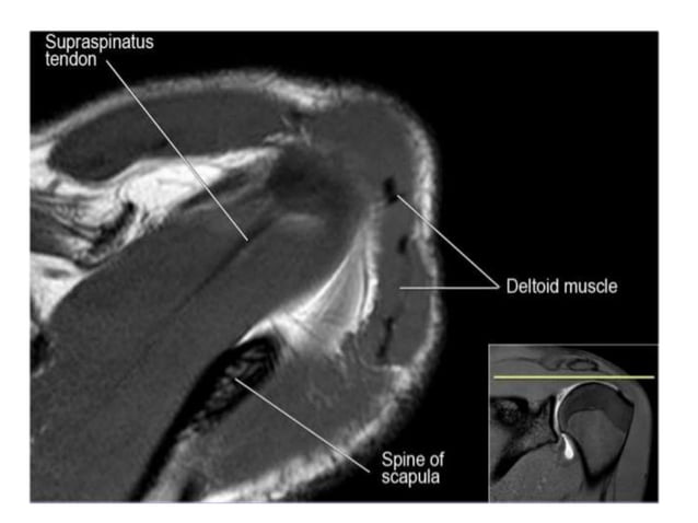 Mri musculoskeletal system | PPTX