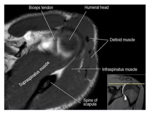 Mri musculoskeletal system | PPTX