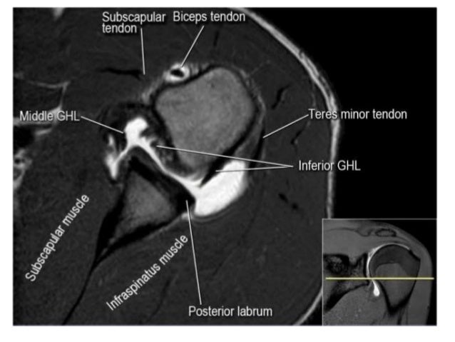 Mri musculoskeletal system