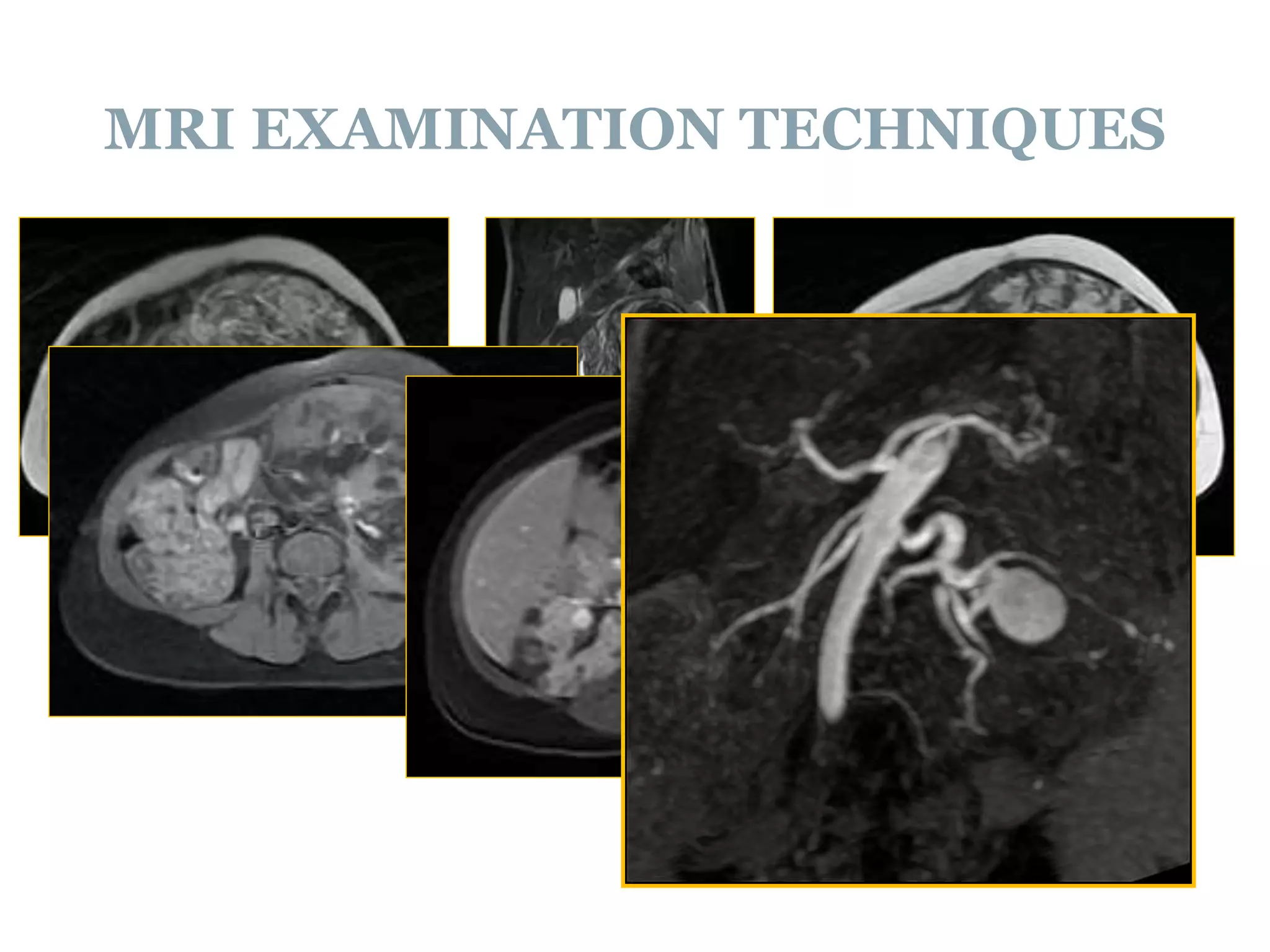 Mri nephrology 2017 | PPTX