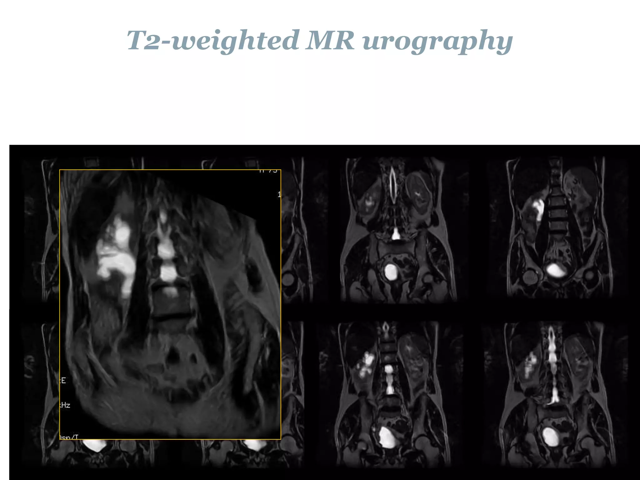 Mri nephrology 2017 | PPTX
