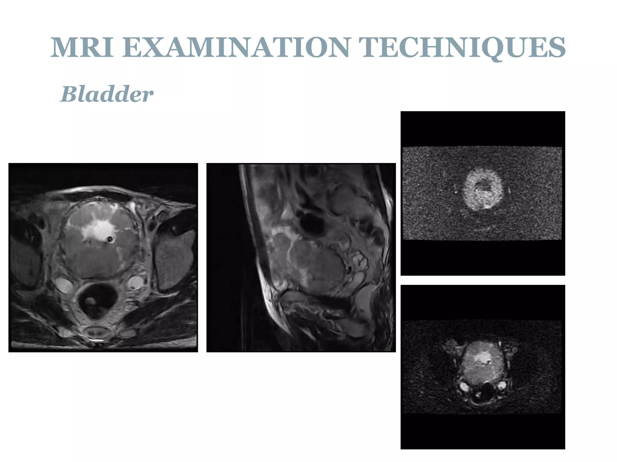 Mri nephrology 2017 | PPTX