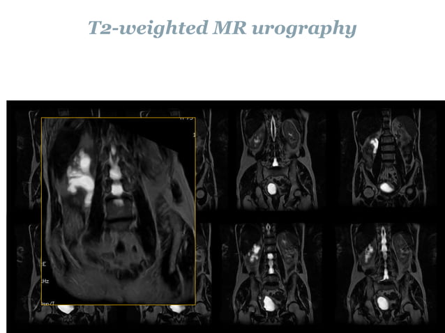 Mri nephrology 2017 | PPTX | Medical Tests | Medical Health