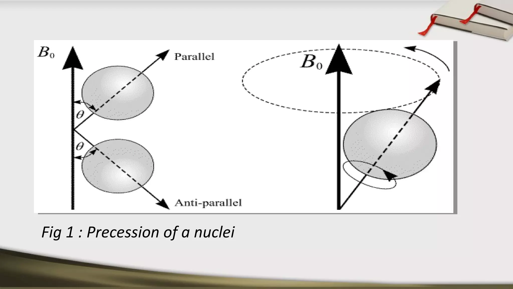 Magnetic Resonance Imaging | PPT
