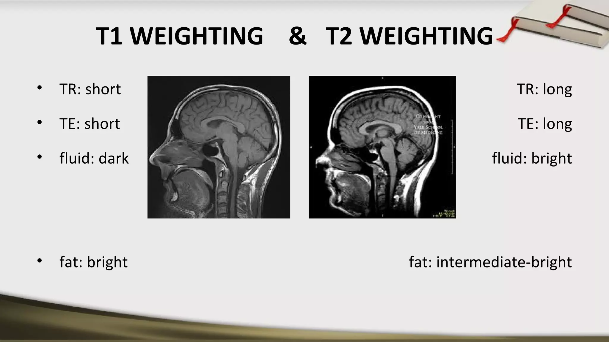 Magnetic Resonance Imaging | PPT