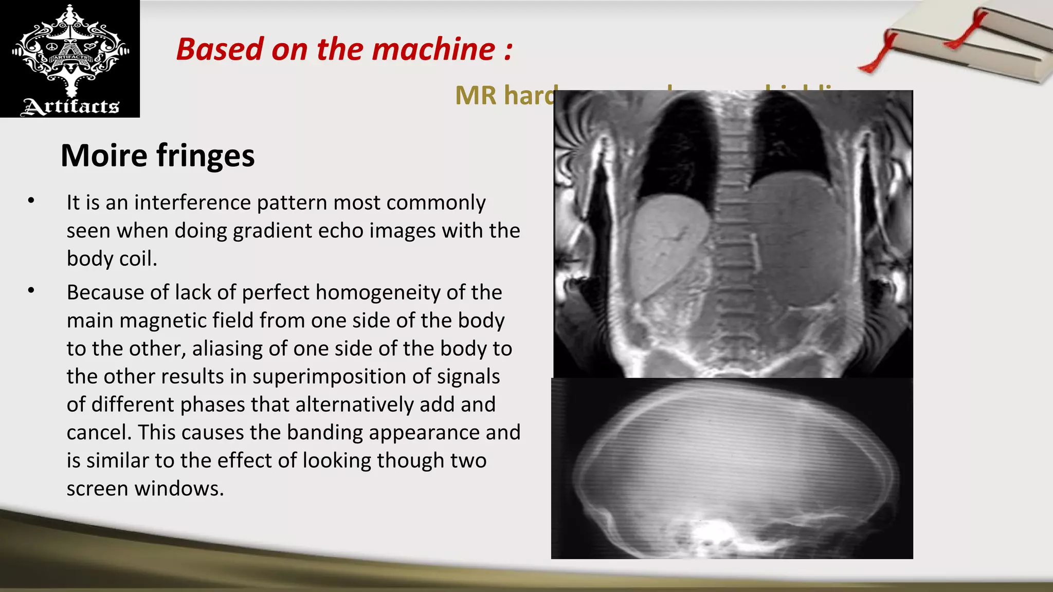 Magnetic Resonance Imaging | PPT