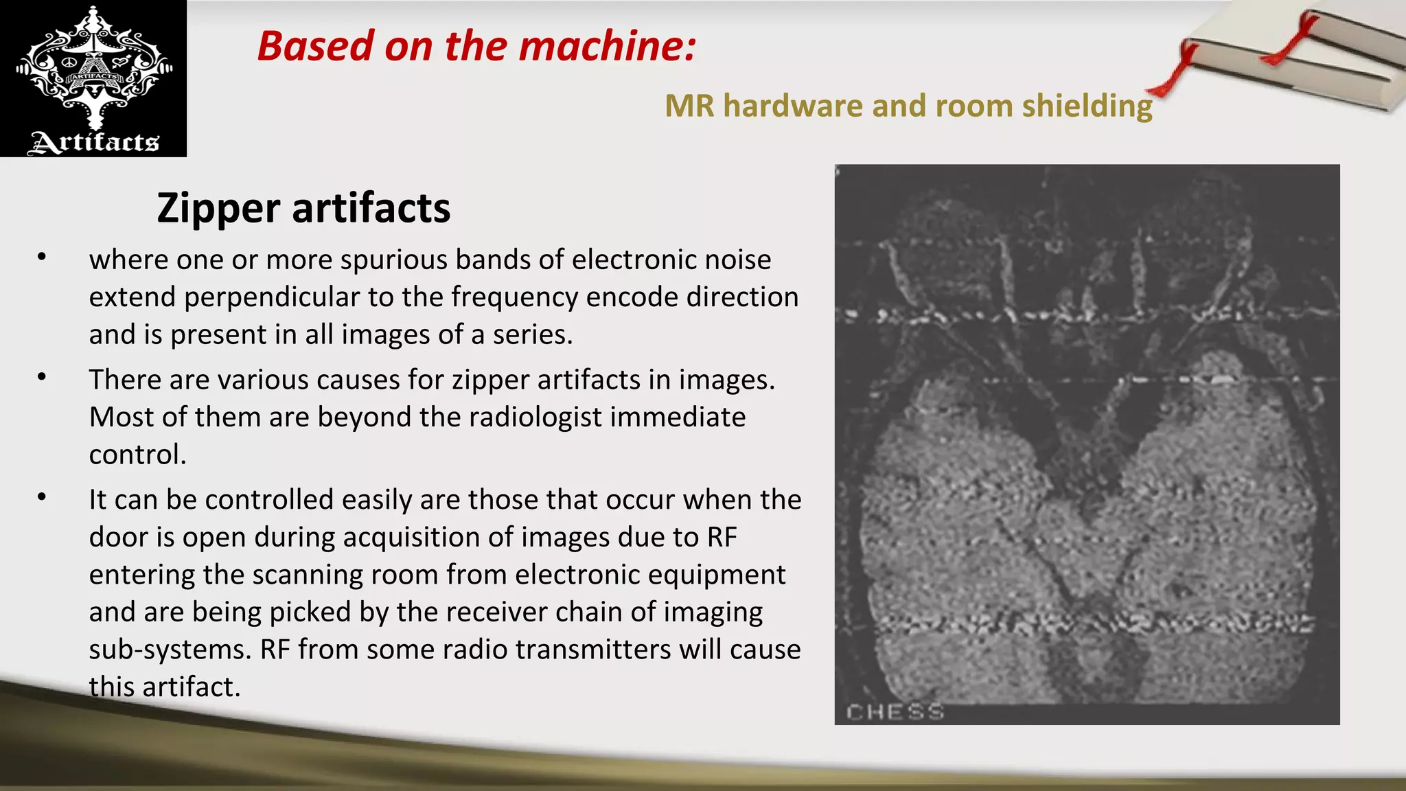 Magnetic Resonance Imaging | PPT