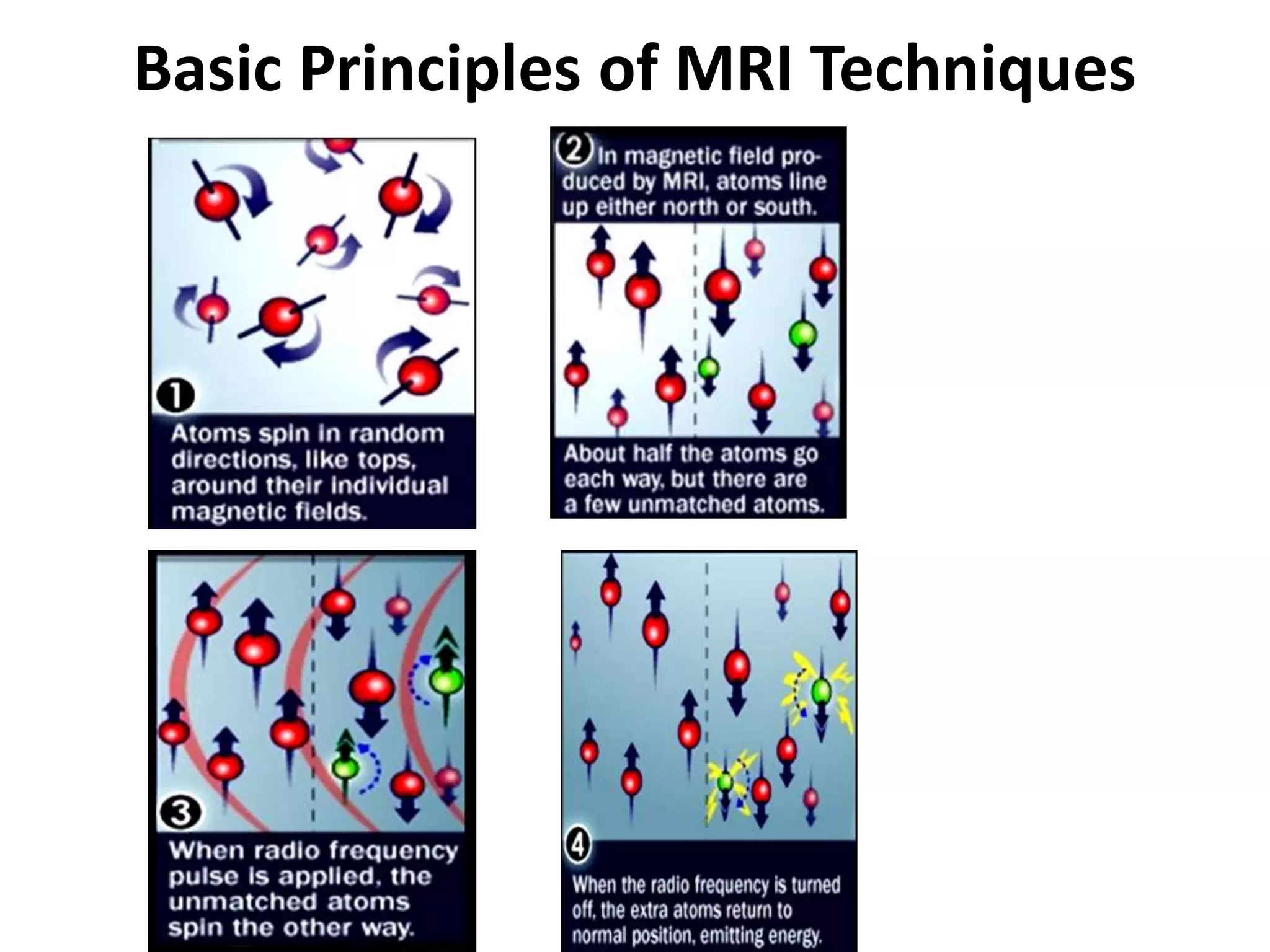 MRI of Brain: Basics | PPTX