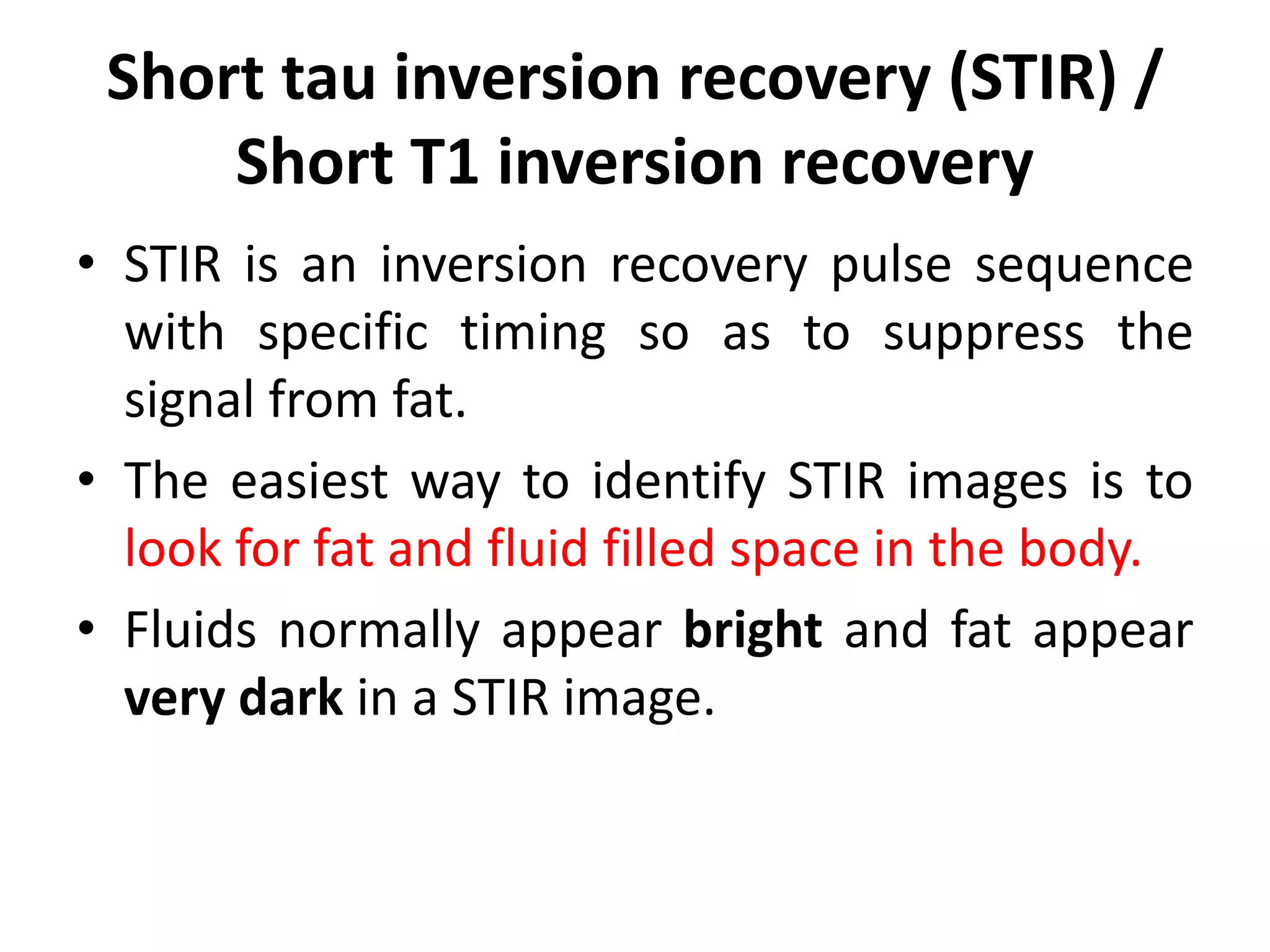 MRI of Brain: Basics | PPTX