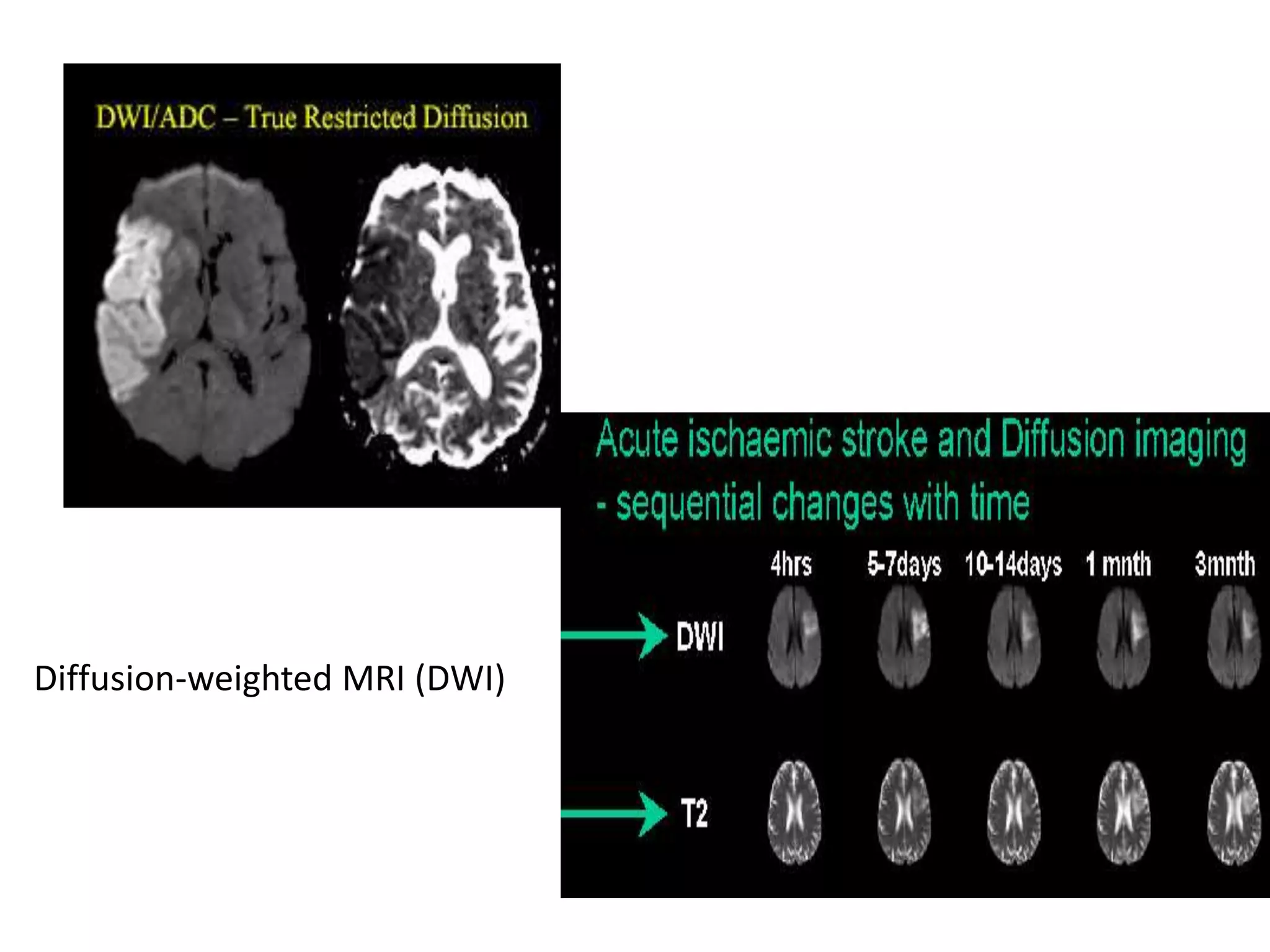 MRI of Brain: Basics | PPTX | Brain and Nervous System Disorders | Diseases and Conditions