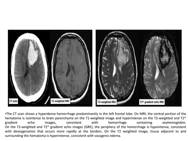 MRI of Brain: Basics | PPTX | Brain and Nervous System Disorders | Diseases and Conditions