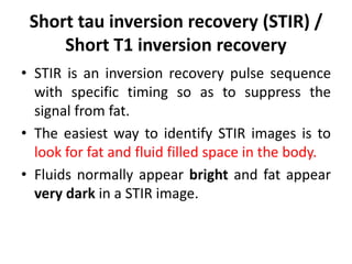 MRI of Brain: Basics | PPTX