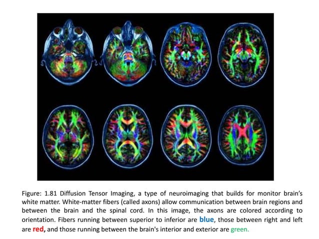 MRI of Brain: Basics | PPTX | Brain and Nervous System Disorders | Diseases and Conditions