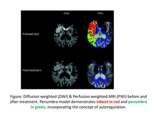 MRI of Brain: Basics | PPTX