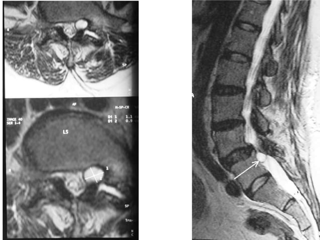 MRI of Interesting Rare Spinal Cases.pptx