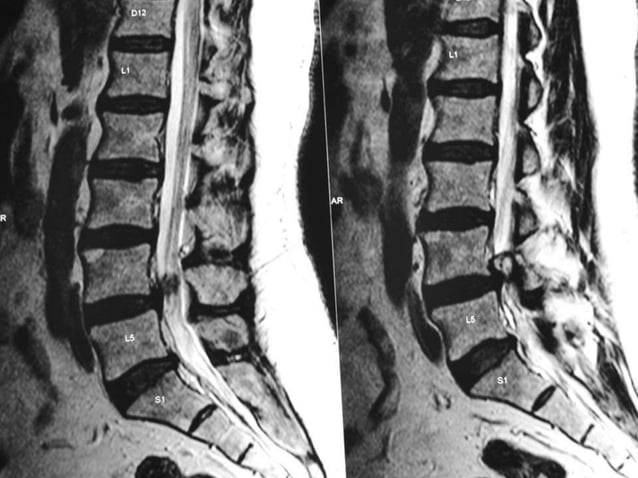 MRI of Interesting Rare Spinal Cases.pptx