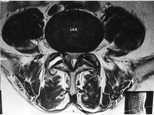 MRI of Interesting Rare Spinal Cases.pptx