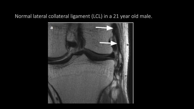 MRI OF KNEE JOINT.pptx