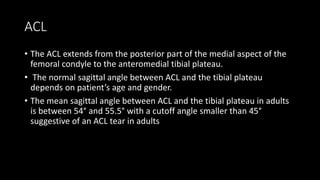 MRI OF KNEE JOINT.pptx