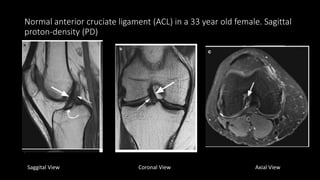 MRI OF KNEE JOINT.pptx