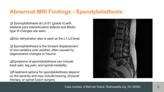 MRI of Lumbar Spine _DR Mohammad Rakib.pptx