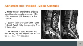 MRI of Lumbar Spine _DR Mohammad Rakib.pptx