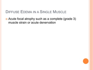 Mri of muscle diseases | PPTX