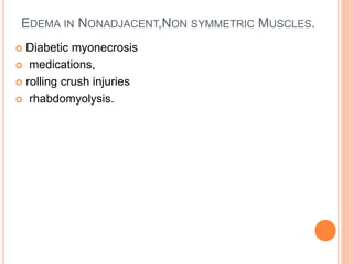 Mri of muscle diseases | PPTX