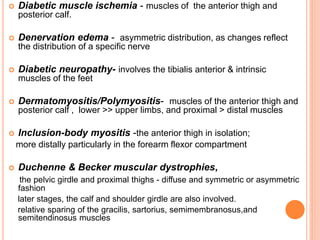 Mri of muscle diseases | PPTX