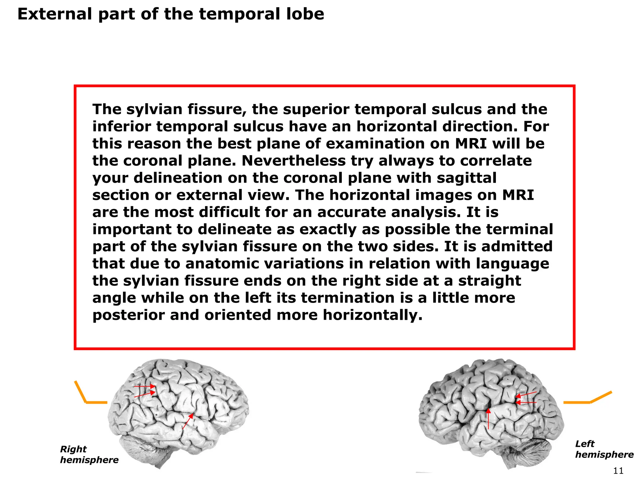 MRI of Normal Brain 3D with labels and lecture | PPT