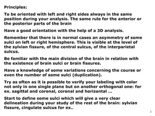 MRI of Normal Brain 3D with labels and lecture | PPT