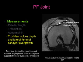 MRI of patellar disorders | PPT