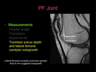 MRI of patellar disorders | PPT