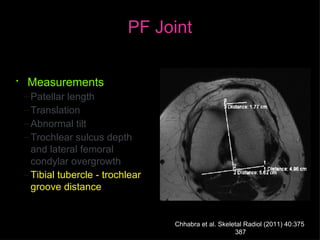 MRI of patellar disorders | PPT