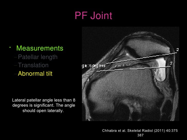 MRI of patellar disorders