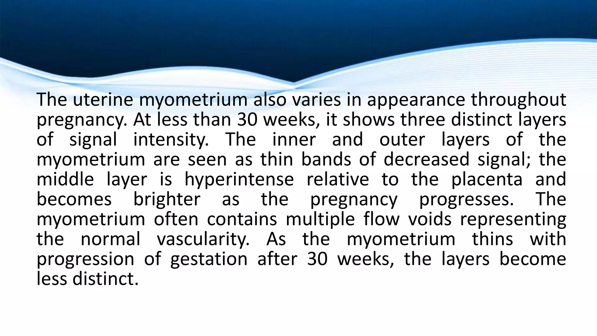 Mri of placenta accreta spectrum | PPTX