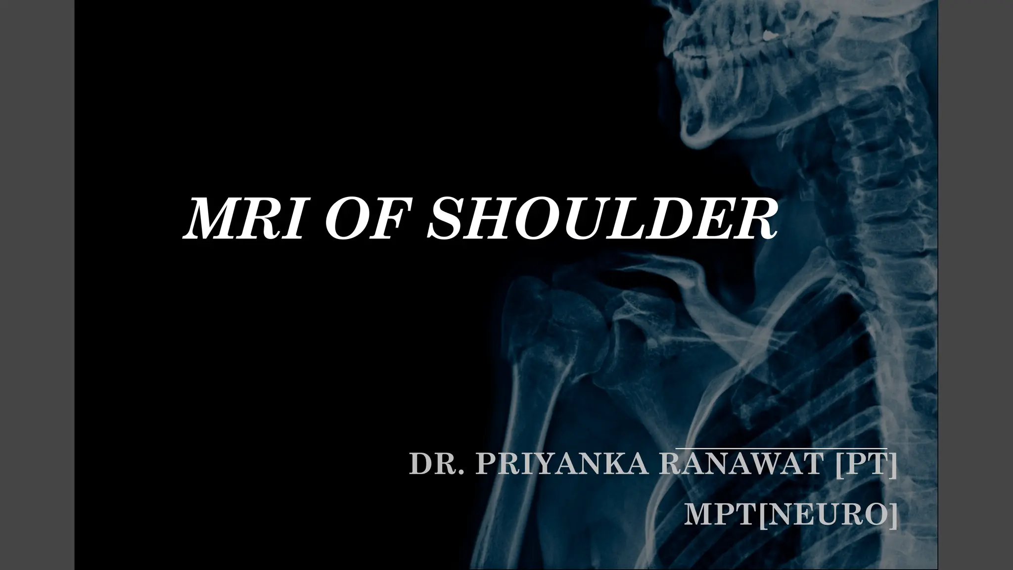 MRI OF SHOULDER.pptx magnetic resonance imaging , used to diagnosis ...