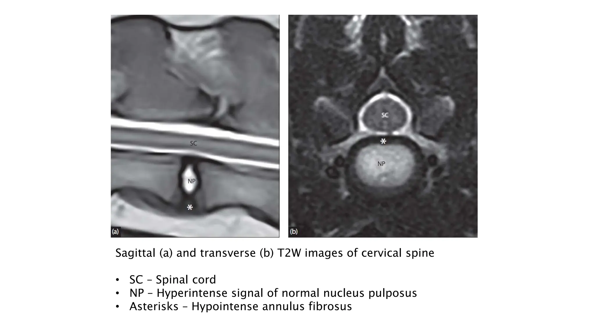MRI of Spinal Cord.pptx MRI of Spinal Cord.pptx Veterinary medicine ...